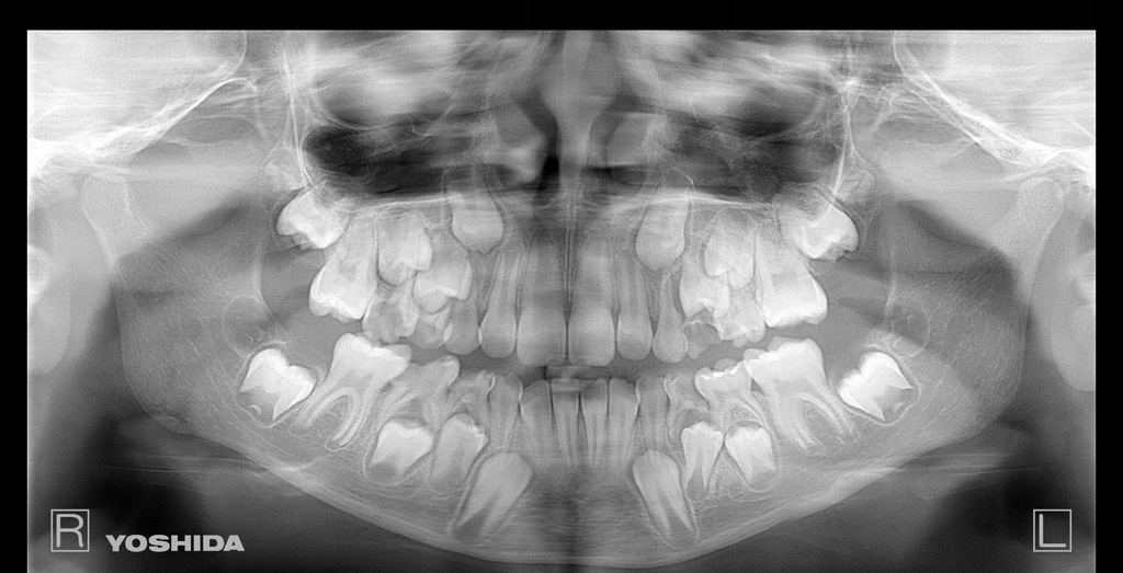 Zdjęcia Panoramiczne, pantomograficzne, rtg zębów - 7554336928 ...